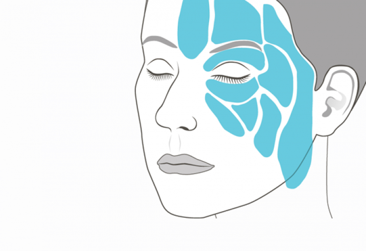 Facial Anatomy: Location of Superficial Fat Packets - Estet-Portal