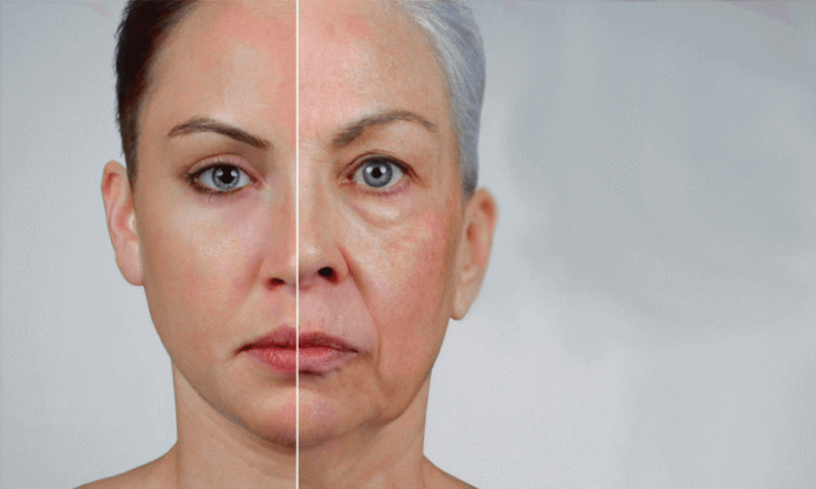 The Anatomy of Facial Aging: The Complementary Effect of Change - Estet ...
