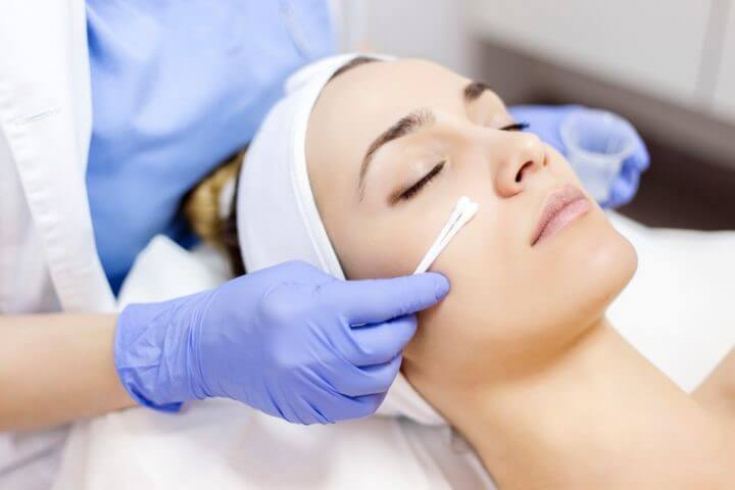 Acne therapy through physical acne extraction and peels - Estet-Portal