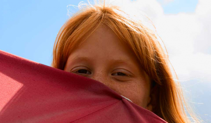 What is the most common cause of sun allergy? - Estet-Portal