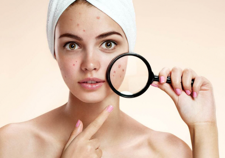 Pyoderma: etiology, classification, prevention and treatment of the ...