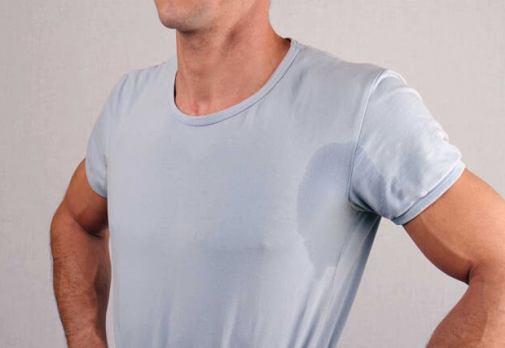 The main clinical signs of primary hyperhidrosis - Estet-Portal
