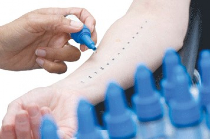 Treatment of allergic dermatitis in the practice of a dermatologist ...