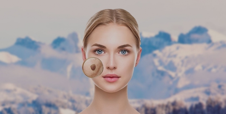 All about the concept of flat warts: causes, diagnosis, treatment ...