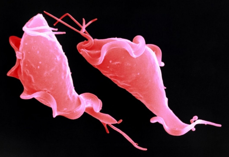 Signs of trichomoniasis: how to recognize the disease in time - Estet ...