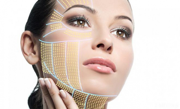 SMAS lifting - lifting of soft tissues of the face and body - Estet-Portal