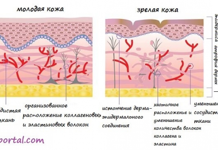 Threadlift 5th generation: the benefits of innovative PLLA threads for ...