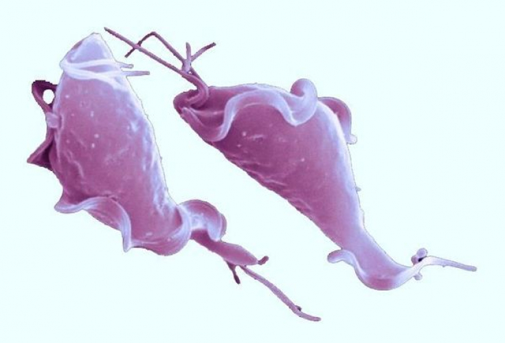 Trichomonas - treatment with folk and traditional methods - Estet-Portal