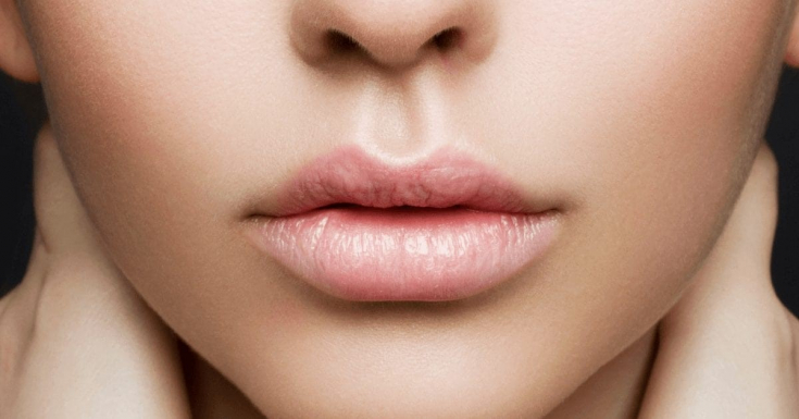 "Tenting" technique for lip contouring with hyaluronic acid filler ...