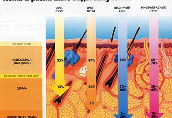 Inflammation of the skin under the sun: what do we know about actinic ...